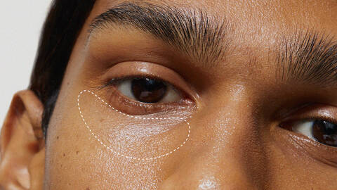 What Causes Puffy Eyes & How To Treat Them | Youth to the People